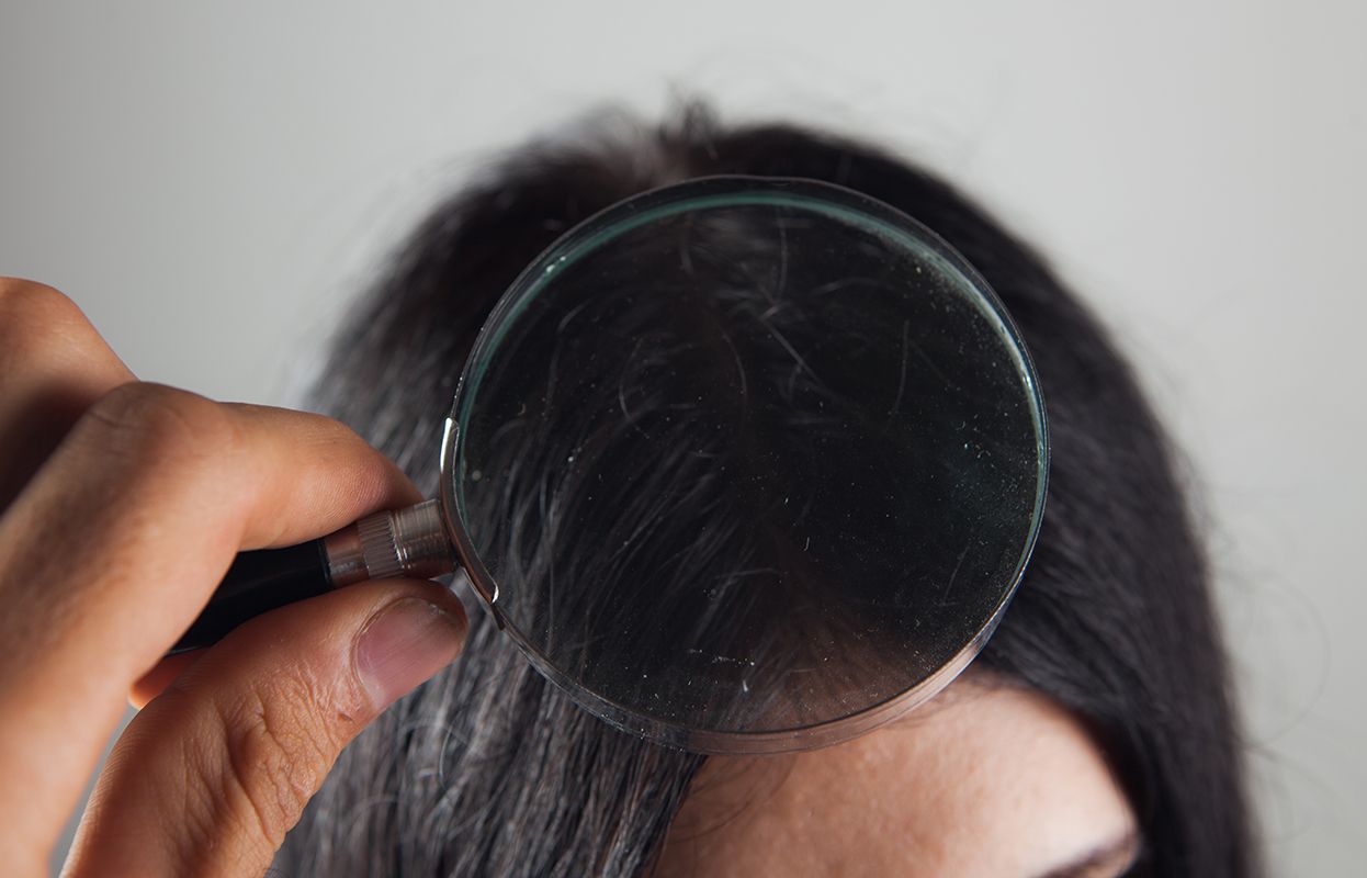Ways to Rejuvenate Your Dry Scalp from Within